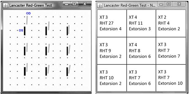 自製Hess Chart Lancaster Chart