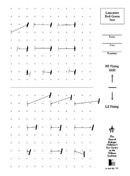 自製Hess Chart Lancaster Chart
